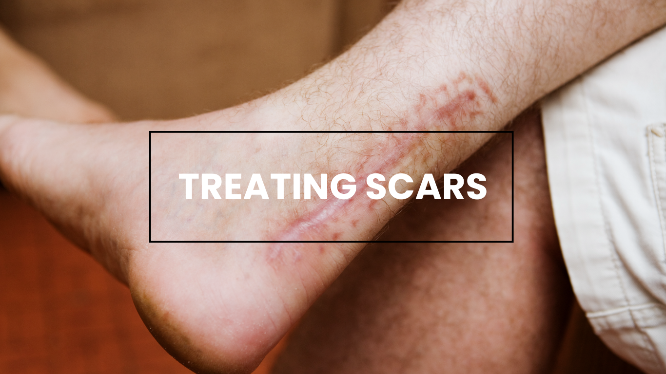 Understanding the Different Types of Scars